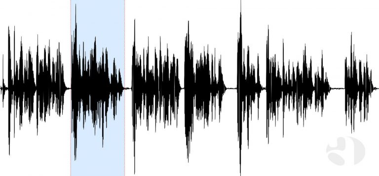 Kurzatmigkeit, Luftnot und andere Atemprobleme beim Sprechen und Singen ...